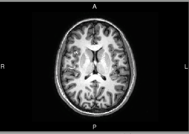 Hersenscans, wat meten ze nou precies? - NEMO Kennislink