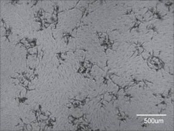 Hoe maak je een bloedvat? Betere doorbloeding is een grote stap in ...