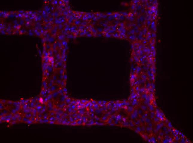 Hoe maak je een bloedvat? Betere doorbloeding is een grote stap in ...