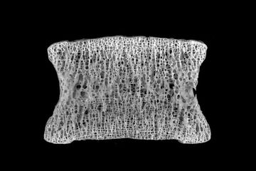 Interne structuur van bot past zich doorlopend aan in reactie op ...