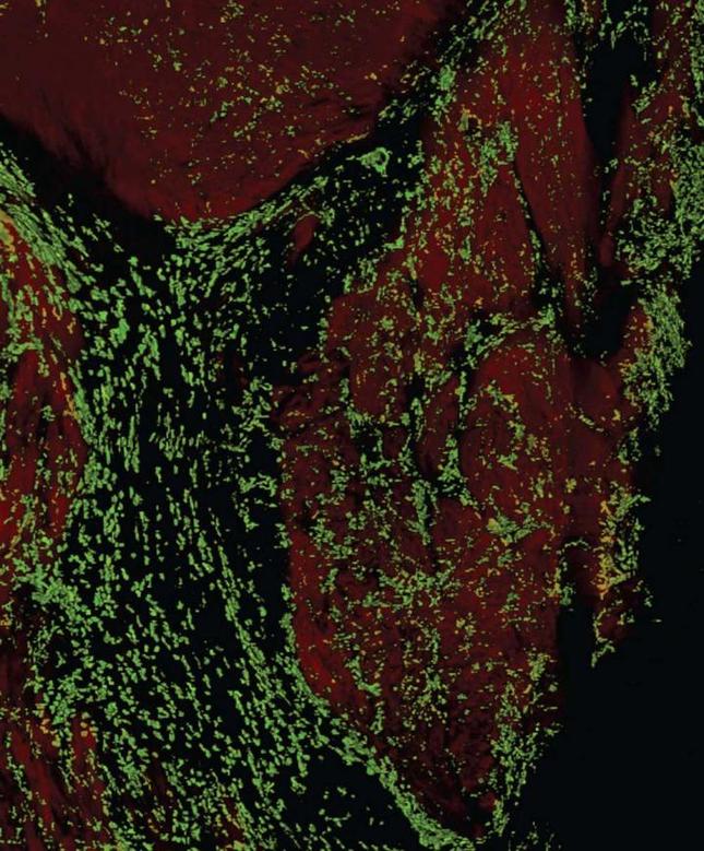 Macrofagen zijn de afvaletende cellen van ons afweersysteem, maar ...