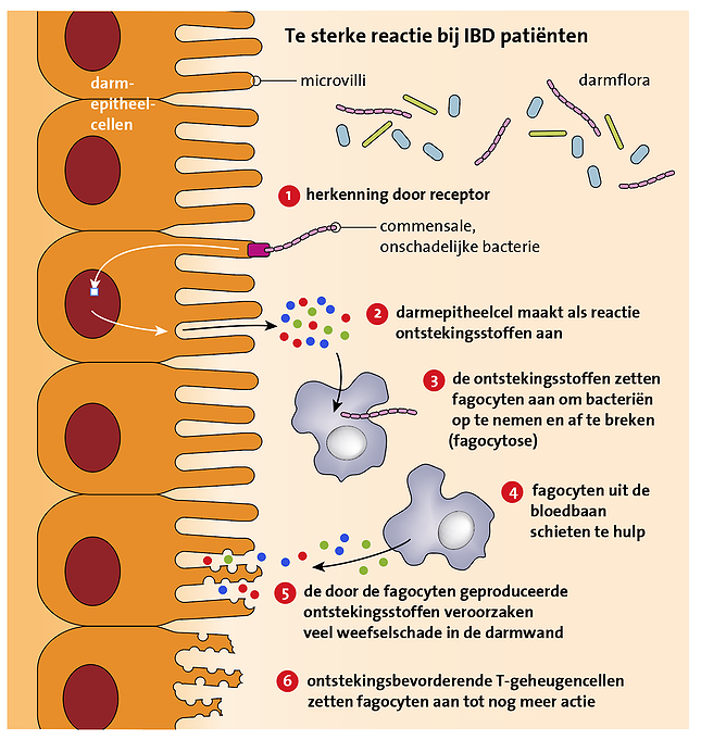 Chronische darmontsteking – ziekte van Crohn en colitis ulcerosa - NEMO ...