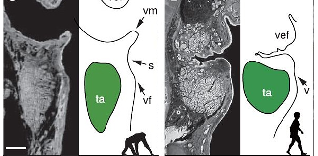 Evolutie stembanden bepalend voor menselijke spraak - NEMO Kennislink