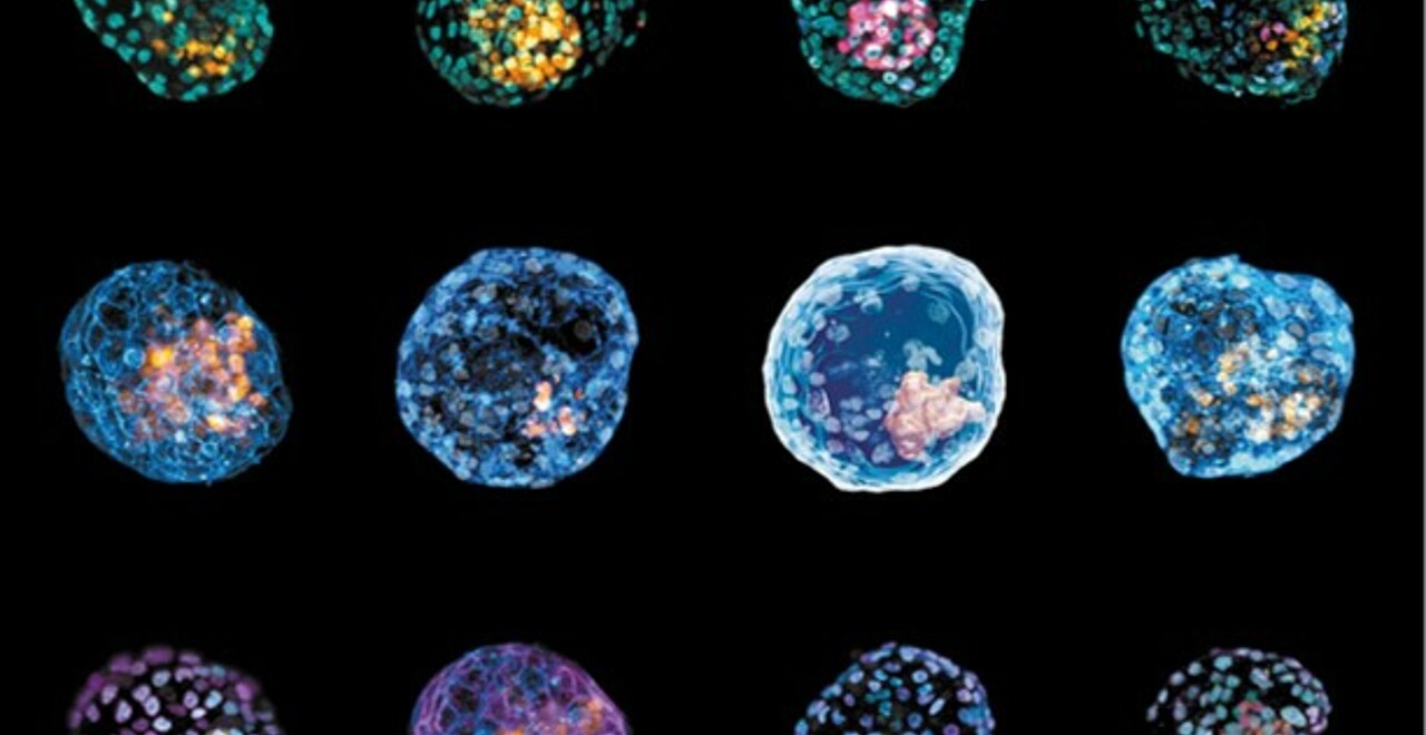 Embryo's uit het lab - NEMO Kennislink